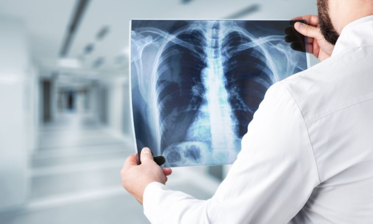 What are X-rays? Benefits and disadvantages of X-Rays